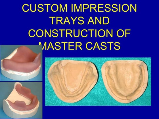 Components of a complete denture | PPT