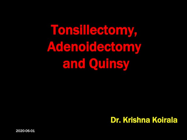 QUINSY (Peritonsillar Abscess) | PPT