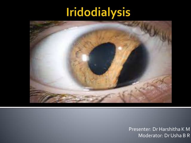 Corneo scleral trauma repair | PPTX