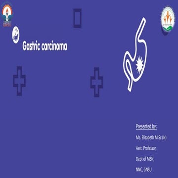 4. Gastric Cancer | PPTX