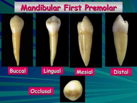 Permanent Maxillary 1st premolar | PPTX | Dental Health | Diseases and ...