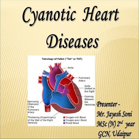 4.TOF, TA, TGA-Cyanotic Heart Dis By- Jayesh Sir | PPT