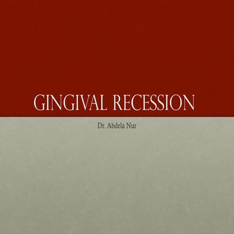 Gingival recession classifications | PPTX
