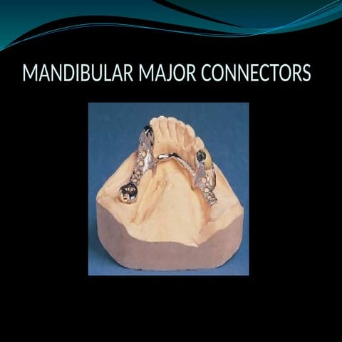Mandibular Major Connectors | PPTX