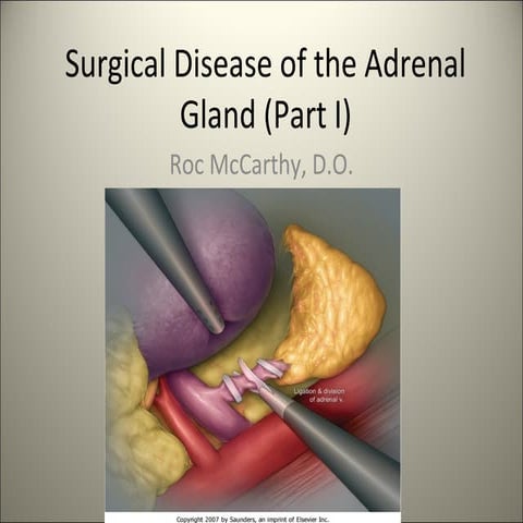 Adrenal gland Surgery(1) | PPT | Endocrine and Metabolic Diseases ...