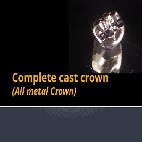 complete cast crown-all metal crown prep | PPTX
