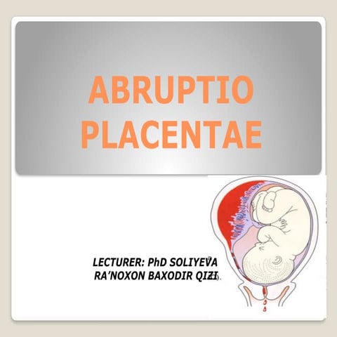 4 - course abruptio-placentae PREVIA SOLIEVA.pptx
