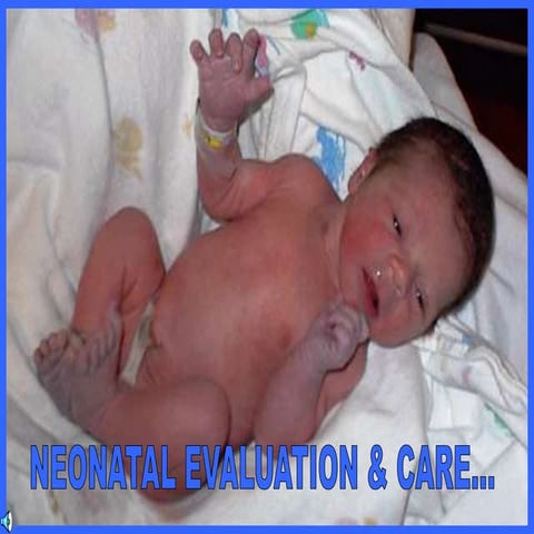 Neonatal-Evaluation-and-management ..ppt