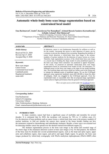 Enhancing Segmentation Approaches from Fuzzy-MPSO Based Liver Tumor Segmentation to Gaussian ...