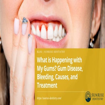 What is Happening with My Gums? Gum Disease, Bleeding, and Causes and ...