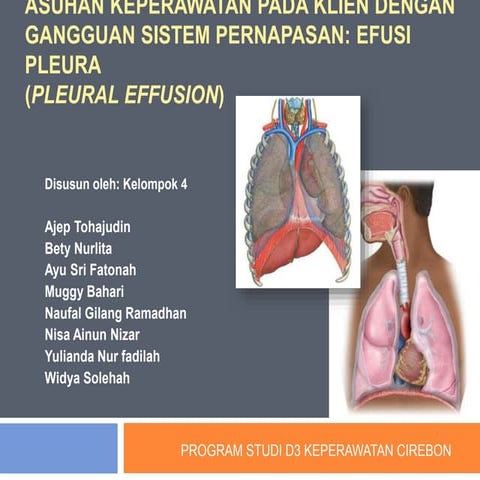 420549310-PPT-ASKEP-Efusi-Pleura.pptx