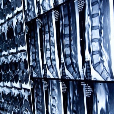 Back pain: how to live with one of the world’s biggest health problems ...