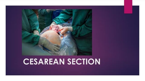 Dilatation and curettage | PPT