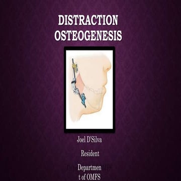 Distraction osteogenesis | PPT