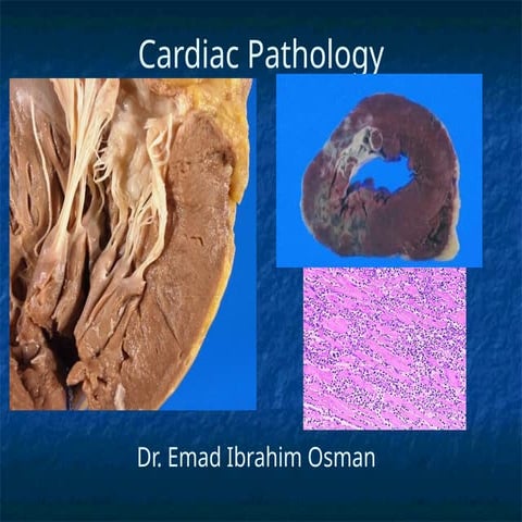 Cardiac Pathology presentation topic.pptx