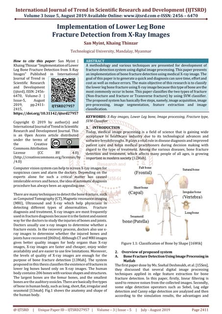 An Image Based Bone Fracture Detection Using Aforge Library Pdf 2835