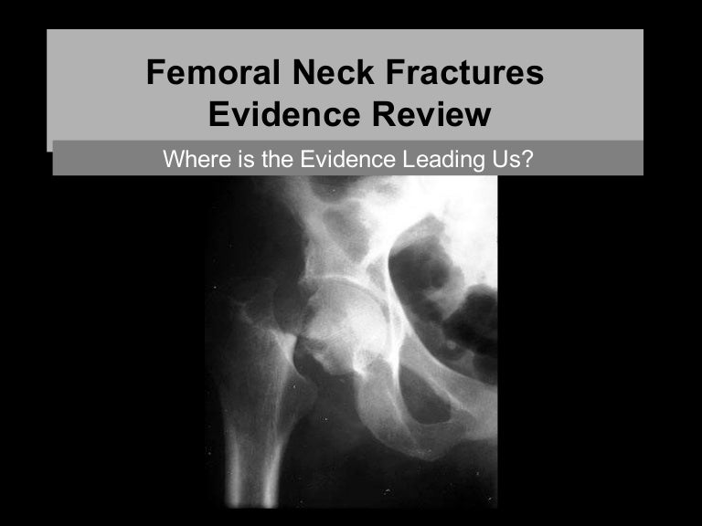 46 Current Evidence About Femoral Neck Fracture Treatment[1]