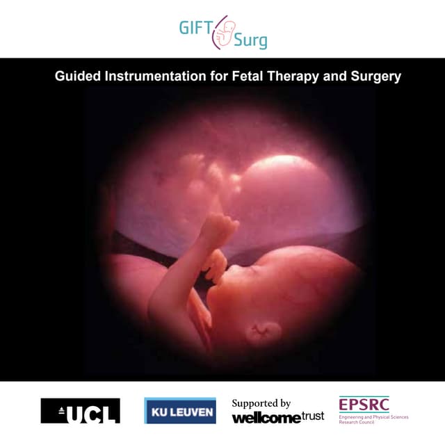 Fetal Surgery | PPTX