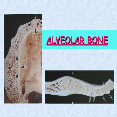 4 ALVEOLAR BONE in periodontology final.ppt