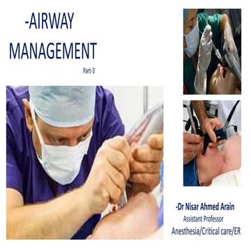 airway management -Anesthesia