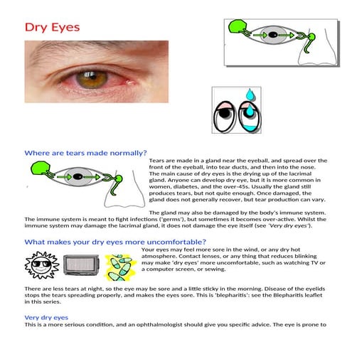 Dry Eyes educational pamphlet for patients | DOCX