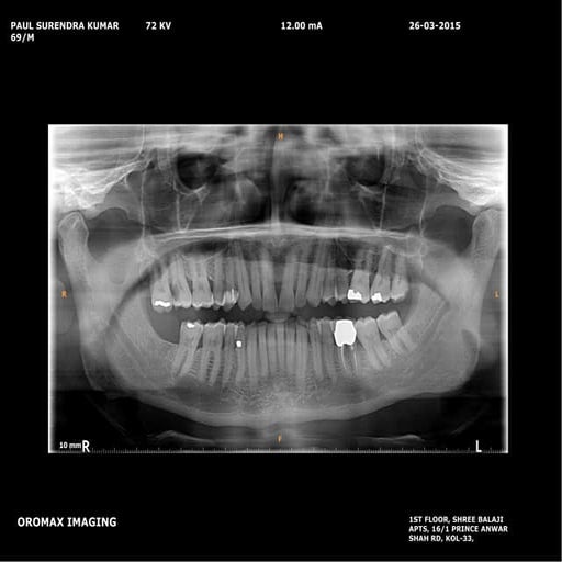 SurendraKumarPaul_OPG (4) | PDF