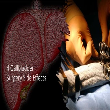 4 Gallbladder Surgery Side Effects | PPT