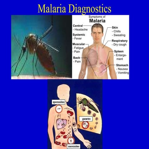 4 Malaria Diagnosis | PPT