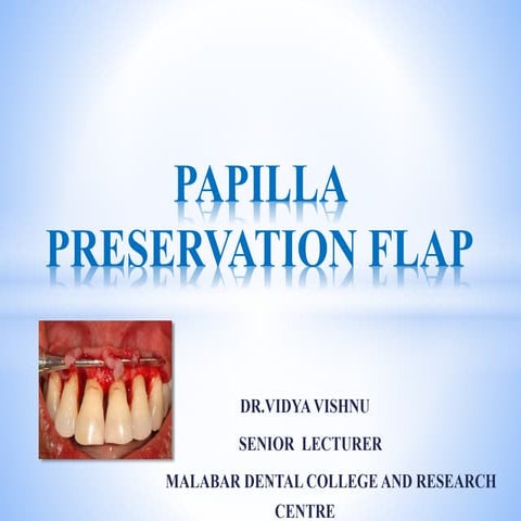 Resective osseous surgery | PPTX