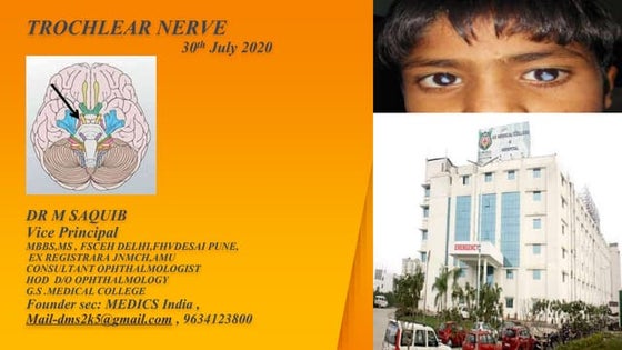Anatomy of trochlear nerve ophthalmology.pptx