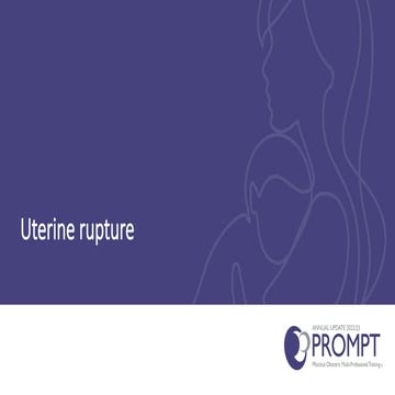 Management of Uterine rupture, obstetric Emergency.pptx