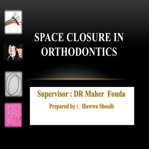 Space closure in orthodontics by elastics | PPTX