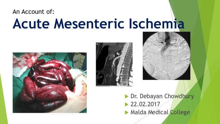 ACUTE MESENTERIC ISCHAEMIA
