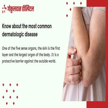 Know about the most common dermatologic disease. | PPT