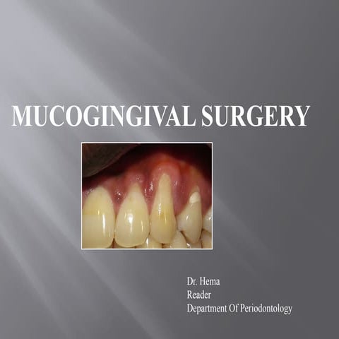 Frenectomy | PPTX