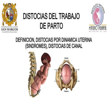 5-6-7 5-DISTOCIAS 6-DISTOCIA UTERINA 7 DISTOCIA DE CANAL DR FERNANDINI ...