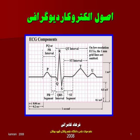 5 parameters of ekg interpretation1 | PDF