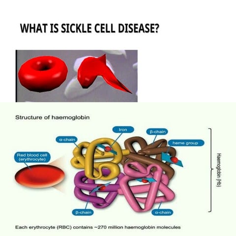 Dr.ASHOK D Sickle-Cell.ppt ............. | PPT