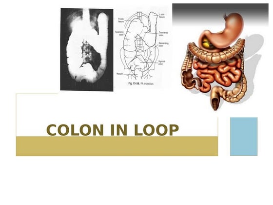 Teknik Pemeriksaan Radiografi Colon In Loop (CIL) | PPTX