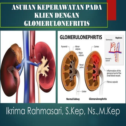 Prosedur pemberian Obat (IC, IM, SC, IV).pptx