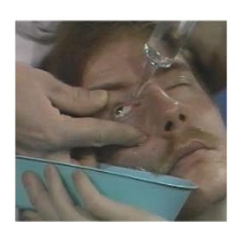 515257129-EYE-IRRIGATION by Dr.Raafat AL-Awadhi.pptx