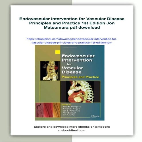 Endovascular Intervention for Vascular Disease Principles and Practice ...