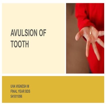 Avulsion.pdf | Dental Health | Diseases and Conditions