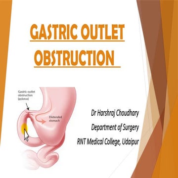 Gastric Outlet Obstruction (GOO) | PPTX