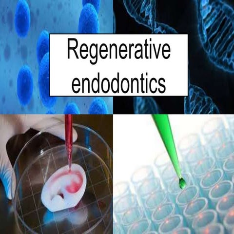 REGENERATIVE ENDODONTICS | PPTX