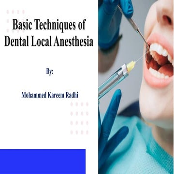 Maxillary infiltration anesthetic techniques (with photos) | PPTX
