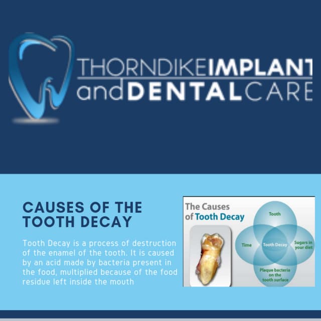 Causes of the tooth decay? | PDF