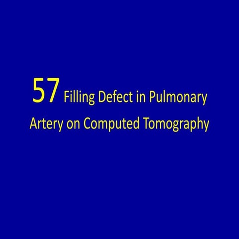 57 filling defect in pulmonary artery on computed | PPTX