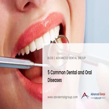 5 Common Dental and Oral Diseases | PDF