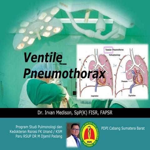 5_pneumotoraks_ventil_dr_Irvan_Medison.pdf
